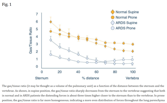 Prone position in ARDS patients | Surgical Focus