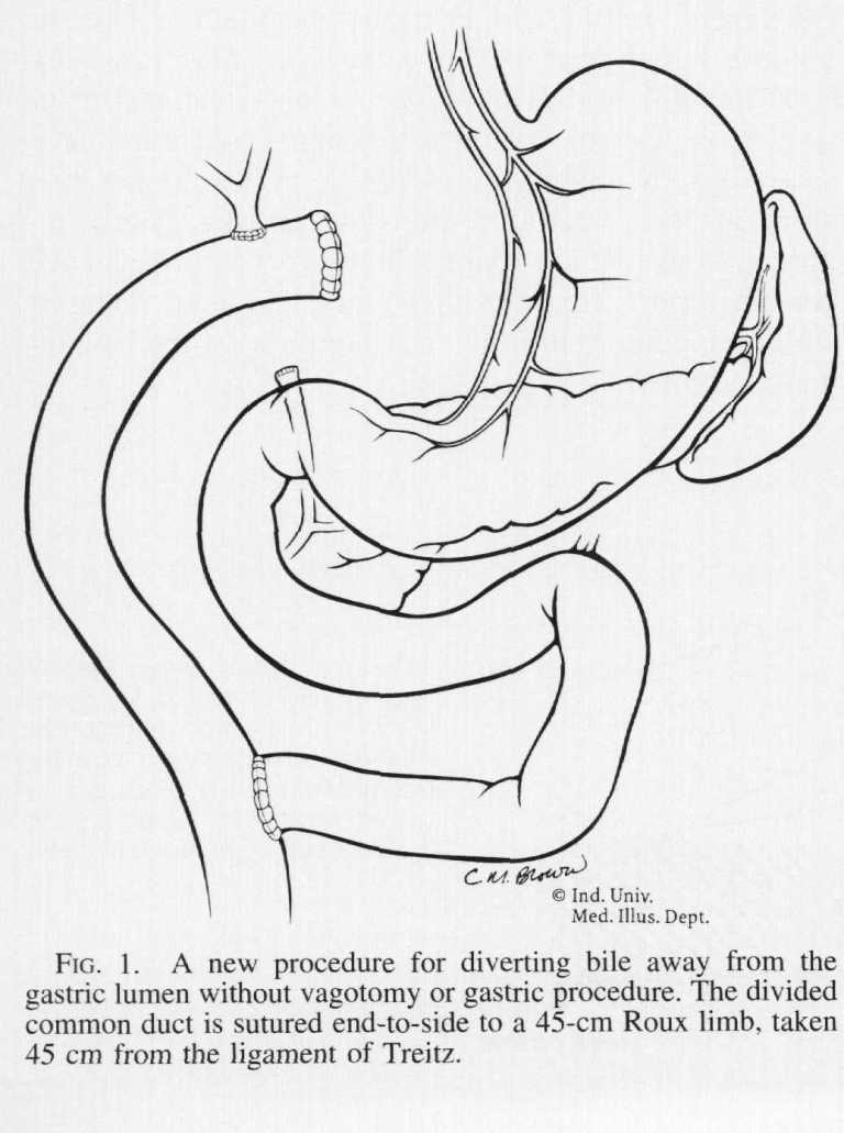 Digestive System Surgical Procedures | Surgical Focus